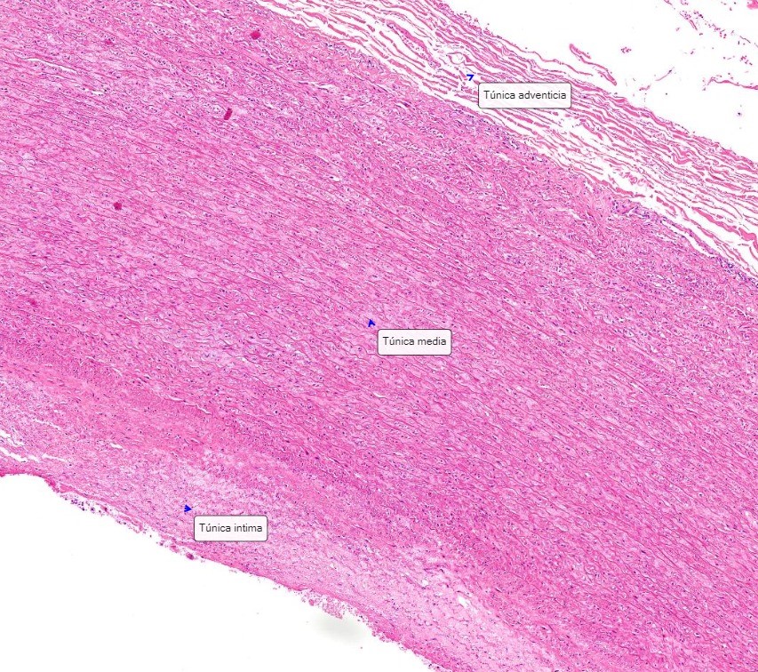 Arteria Elástica - Laboratorio de biología Interactiva