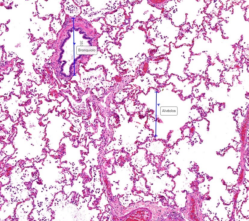 Pulmón - Laboratorio de biología Interactiva
