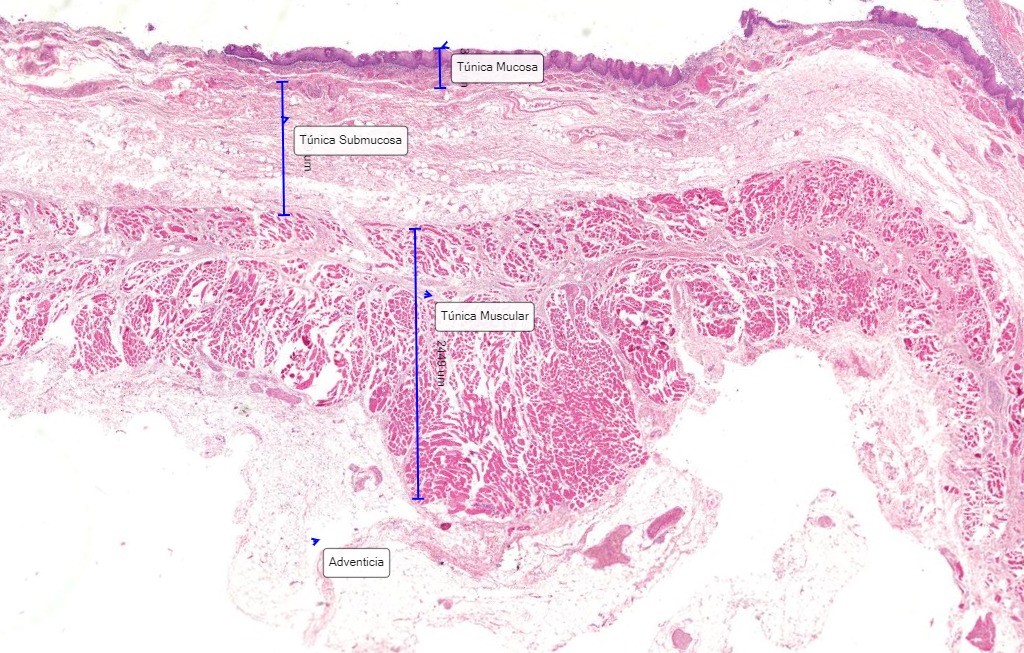 Esófago - Laboratorio de biología Interactiva